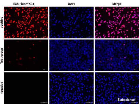 High Affinity And Specificity One Step TUNEL Assay Kit Red AF594 E
