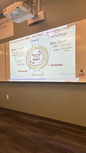 Chapter 4 Atrial Rhythms Flashcards Quizlet