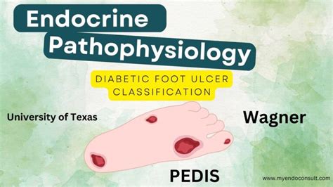 Diabetic Foot Ulcer Stages A Concise Guide My Endo Consult