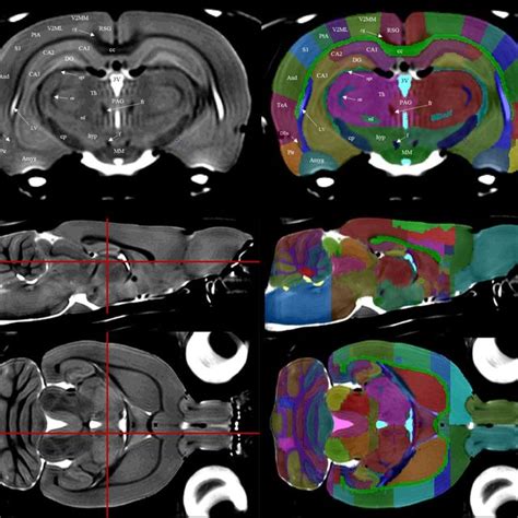 typical example of brain mr intensity image left and its label map download scientific