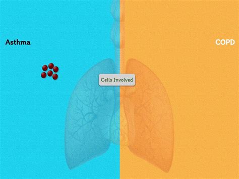 Asthma Vs COPD Know The Differences And Similarities On Account Of World Asthma Day OnlyMyHealth