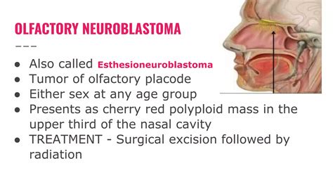 Malignant Tumors Of Nose And Pns Pdf
