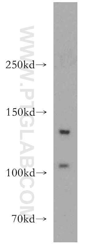 Tgfbr3 Specific Antibody 20000 1 Ap Proteintech