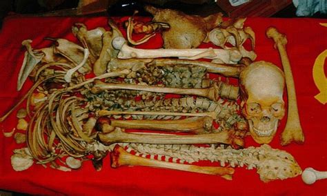 Swedish Woman Accused Of Using A Skeleton For Sex Says She Is An Odd Duck But Not A Criminal