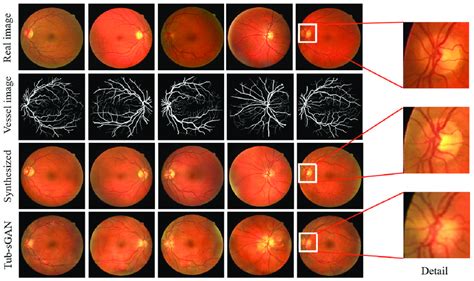 Results Of Our Experiment On Drive Dataset For Each Column The 1st Download Scientific