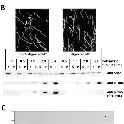 Stu2p Does Not Strongly Require The Cooh Terminus Of β Tubulin For