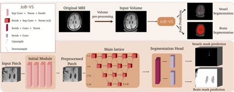 Job Vs Joint Brain Vessel Segmentation In Tof Mra Images Cinfonia