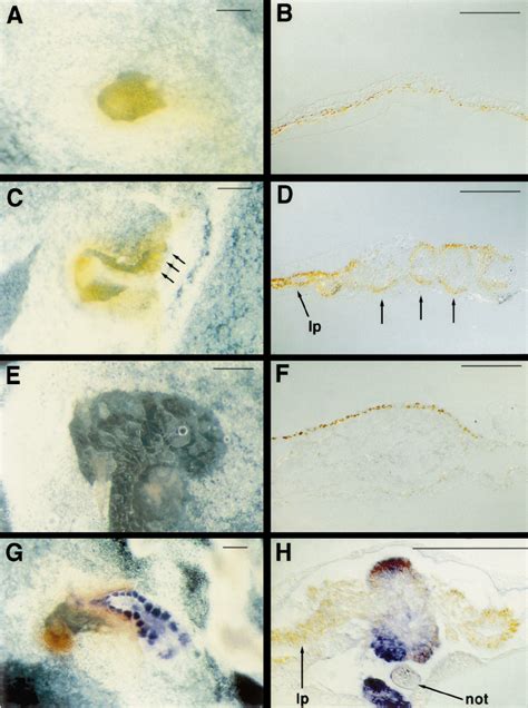 Hensens Node Dorsalises Ventral Mesoderm A Quail Stage 5 Posterior