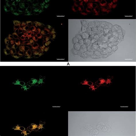 Ratio Analysis Of Lipid Peroxidation Fluorescence Probe Bodipy® C11