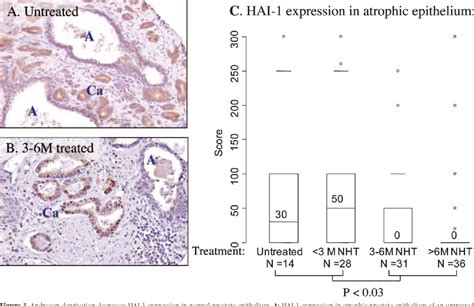 Figure 3 From Tumorigenesis And Neoplastic Progression Regulation Of Hepatocyte Activator