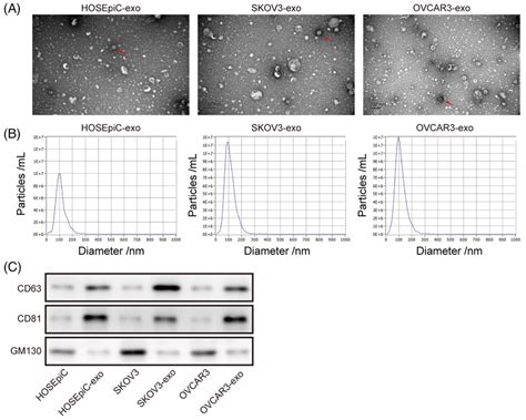 Isolation And Identification Of Exosomes In Ovarian Cancer Cells