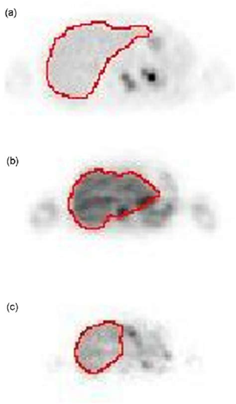 The Shape And Location Of The Initial Curve A Obtained From Result Of Download Scientific