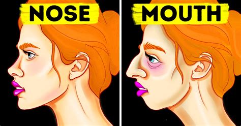 Adenoid Face