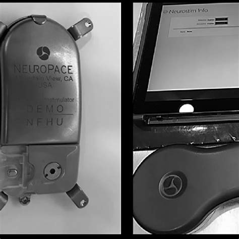 A Neurostimulator Kit 1 Neurostimulator 2 Craniectomy Template Download Scientific