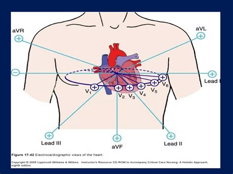 Ekg Myocardial Ischemia And Infarction Ppt