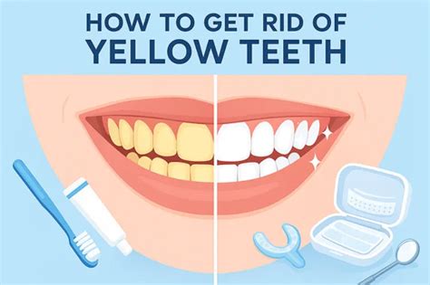 How To Get Rid Of Yellow Teeth Complete Whitening Guide