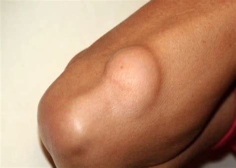 Diseases রোগ Dm3s