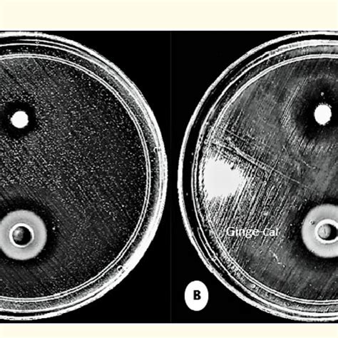 Antimicrobial Susceptibility Test By Disc Diffusion Method And The Download Scientific Diagram