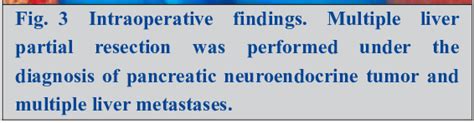 Intraoperative Findings Multiple Liver Partial Resection Was Performed