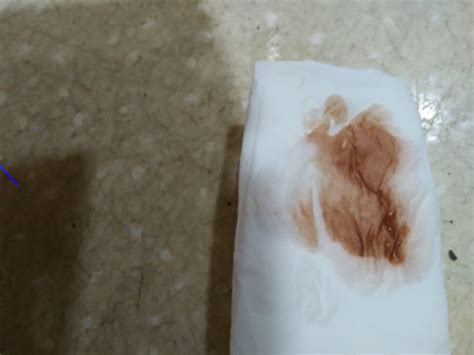 着床失败分泌物有特点根据颜色图片即可轻松辨别 柚喜问答