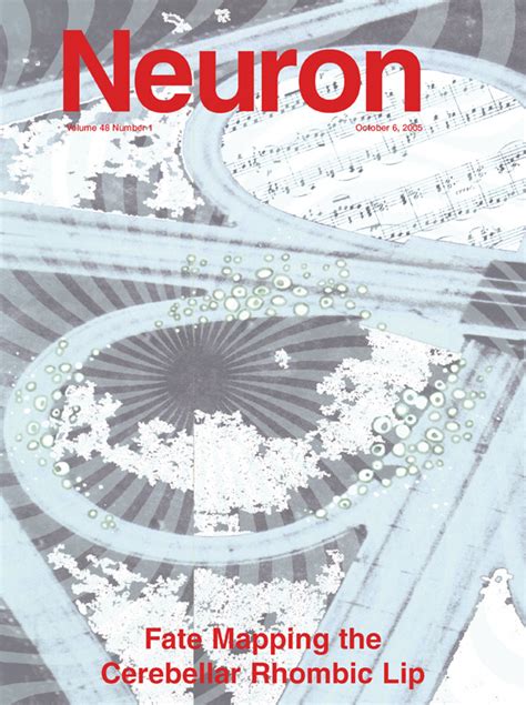 Issue Neuron
