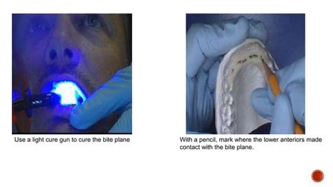 Deprogramming Spilnt 1 Pptx Dental Health Diseases And Conditions