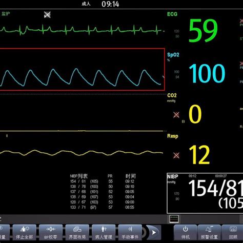Ppg Waveform Examples Of Patients With Hypertension Download Scientific Diagram