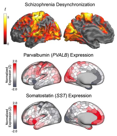 Alterations In The Local Synchrony Of The Cerebral Cortex In Download Scientific Diagram