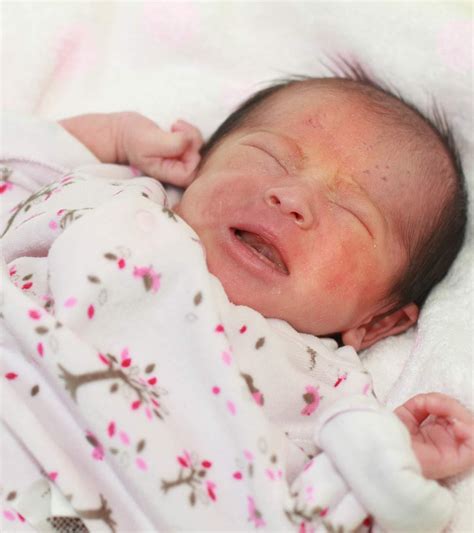 Neonatal Group B Strep Rash