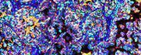 Advancing Cellular Research Through Multiplex Immunohistochemistry