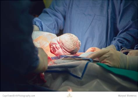 Vén bức màn bí mật phía sau những phòng sinh mổ