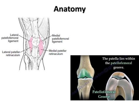 Habitual Dislocation Of Patella Pptx