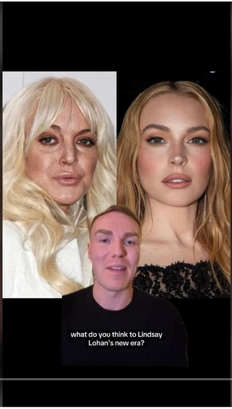 Why Does Lindsay Lohan Look So Different Plastic Surgery Expert