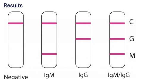 Pahami Makna Hasil Rapid Test Ini Penjelasannya Health Liputan6 Com