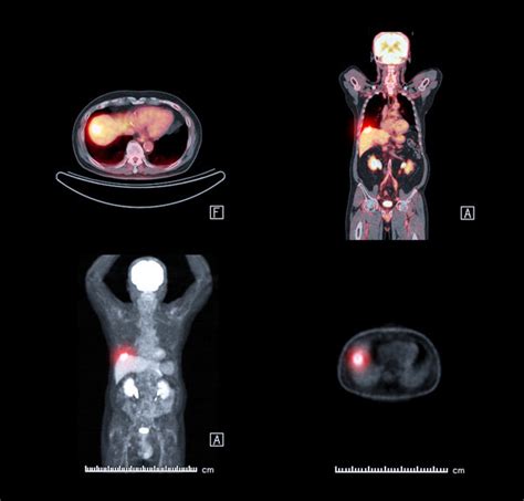 What Is Radionuclide Imaging Techniques At Sharon Sutherland Blog