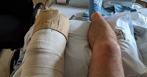 Comparison Pics Album On Imgur