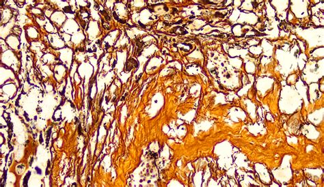 网状纤维染色 检测服务 雷根生物