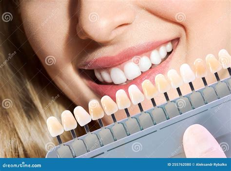 What Is The Healthiest Teeth Color At Paige Lambert Blog