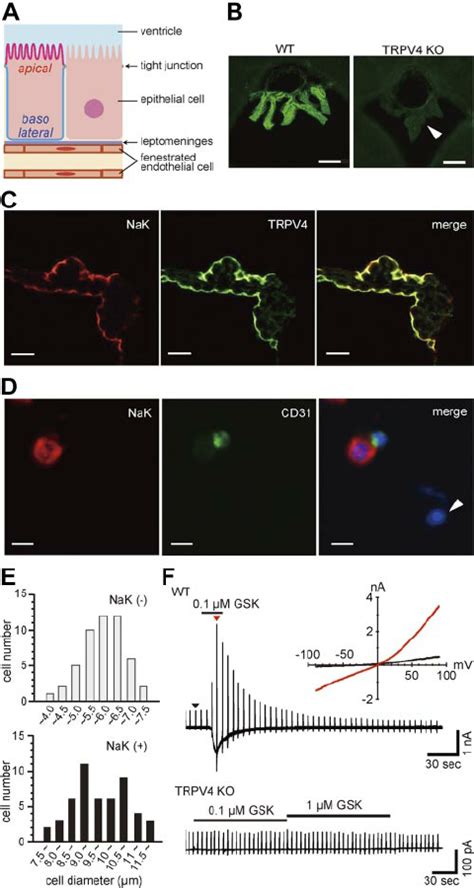 Histological Analysis Of The Mouse Choroid Plexus A Schematic Download Scientific Diagram