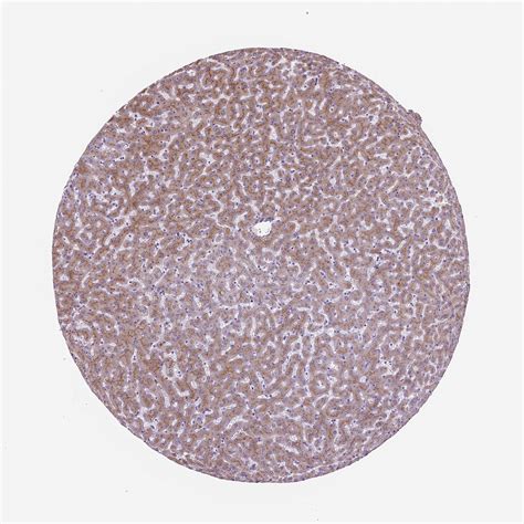 Tissue Expression Of Apoe Staining In Liver The Human Protein Atlas