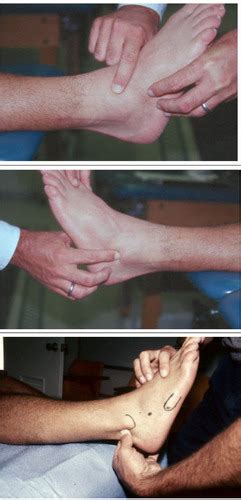 Lateral Ankle Injury Flashcards Quizlet