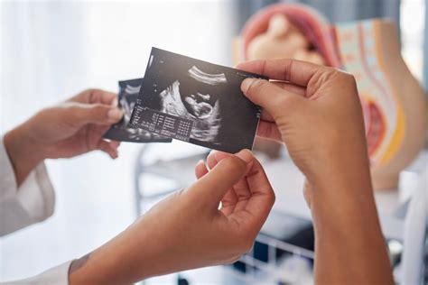 Sonogram Vs Ultrasound Understand Prenatal Imaging