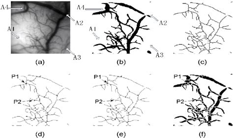 Figure 2 From Separation Of Arteries And Veins From Optical Imaging Of