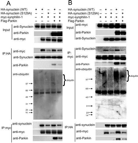 α Synuclein Phosphorylation Enhances Eosinophilic Cytoplasmic Inclusion Formation In Sh Sy5y