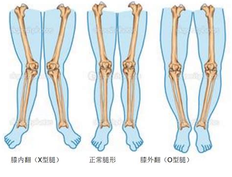 跑步伤膝盖正确姿势很重要 十个方法拯救你的跑步膝 知乎