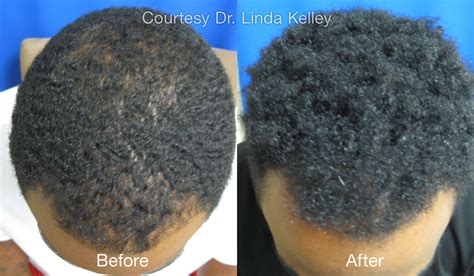 Home Page Cobb Wellness And Aesthetics