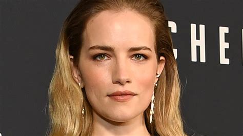 What Plastic Surgery Has Willa Fitzgerald Done Lovely Surgery