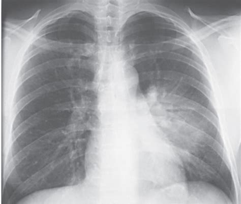 Radiology Lecture 2 Flashcards Quizlet