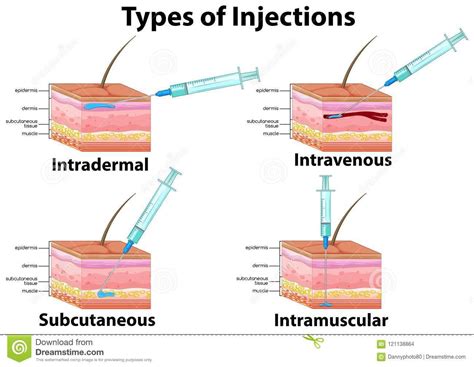 Types Of Injections Artofit