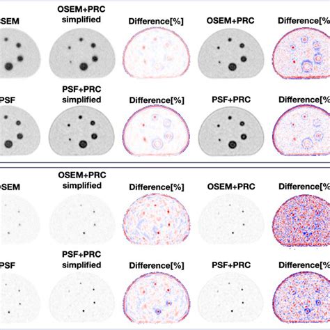 Comparison Of The Reconstructed A Nema Image Quality Phantom With
